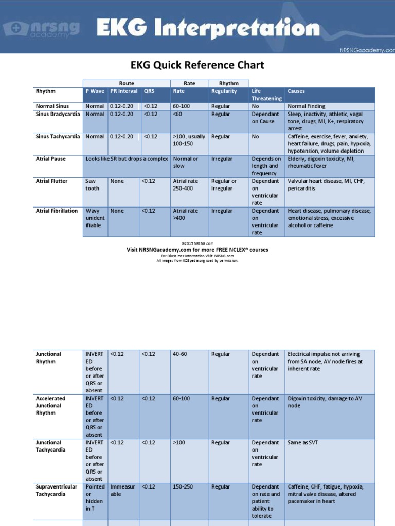 EKG Quick Reference Chart | PDF | Electrophysiology | Circulatory System