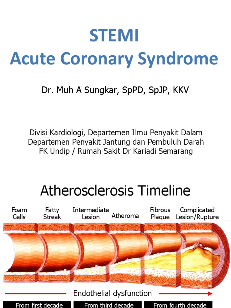 Stemi Acute Coronary Syndrome: Dr. Muh A Sungkar, SPPD, SPJP, KKV | PDF ...