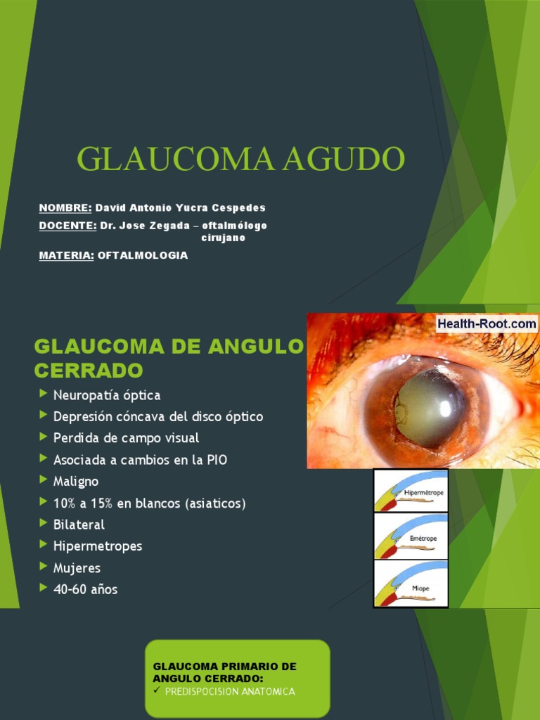 Glaucoma Agudo | PDF