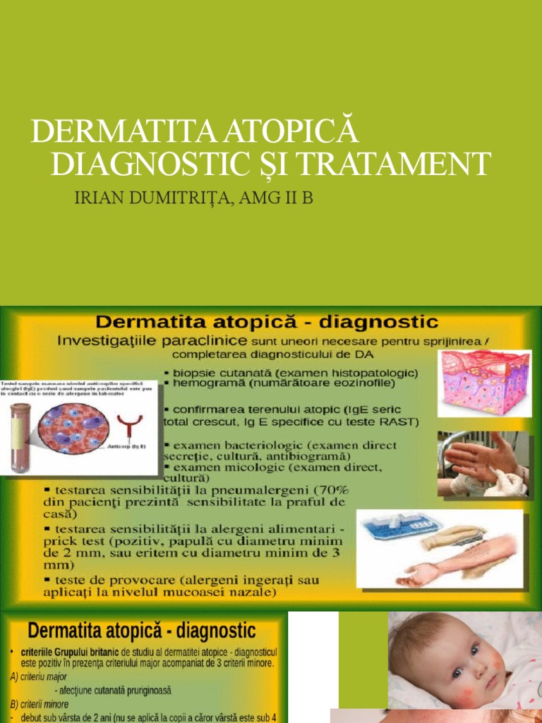 Dermatita Atopica Diagnostic Si Tratament AMG II B | PDF