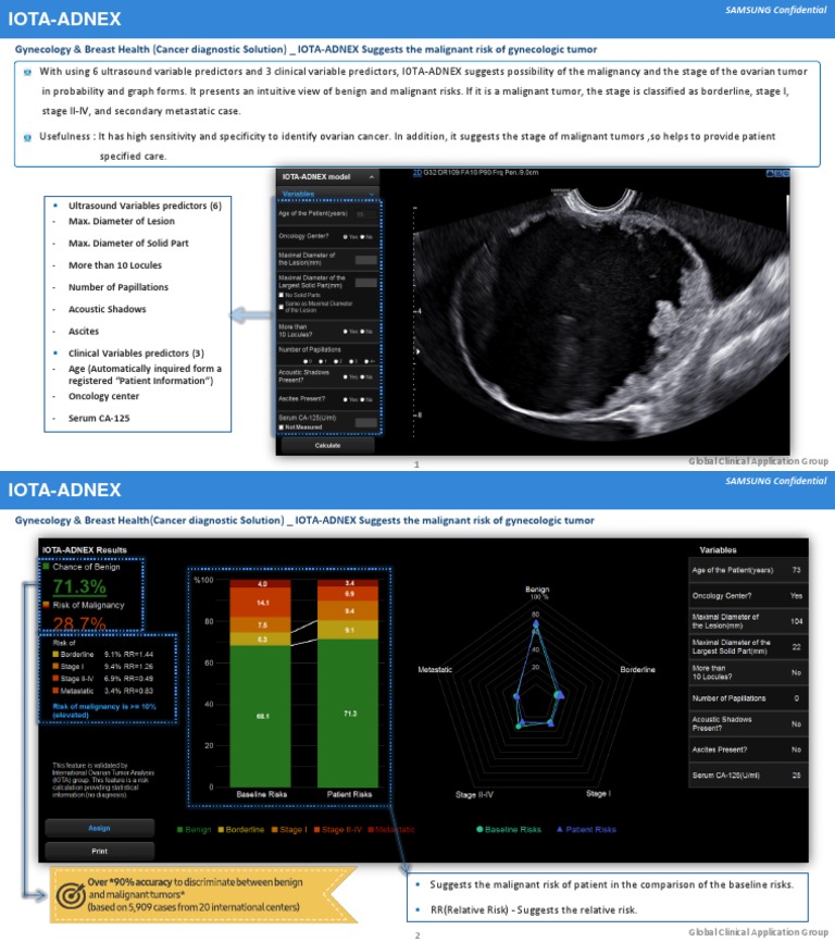 Gynecology & Breast Health (Cancer Diagnostic Solution) - IOTA-ADNEX ...