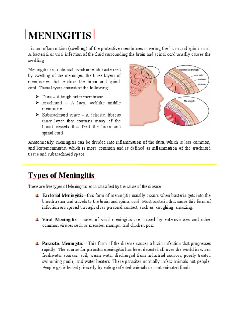 Types of Meningitis | PDF | Meningitis | Health Sciences