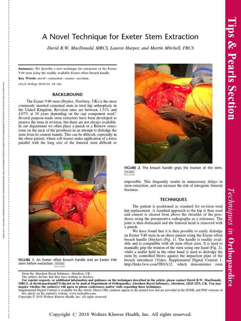 A Novel Technique For Exeter Stem Extraction.8 | PDF | Surgical ...