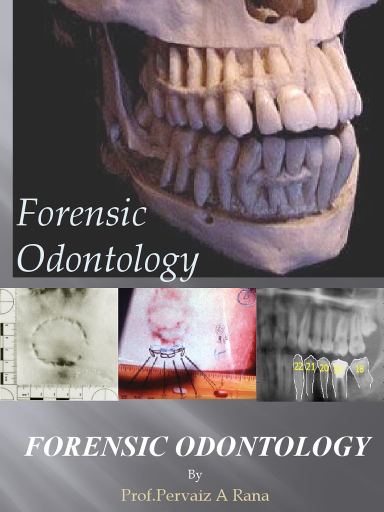 Forensic Odontology DR Rizwan | PDF | Dna Profiling | Tooth