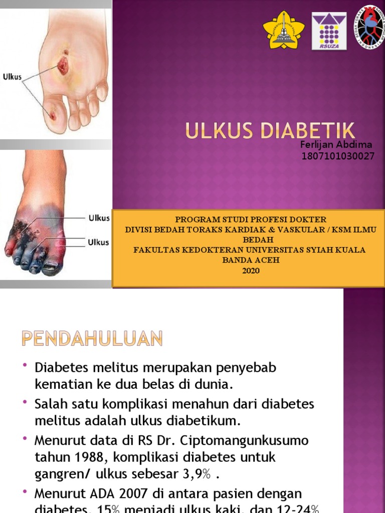 Ulkus Diabetik | PDF | Sains & Matematika