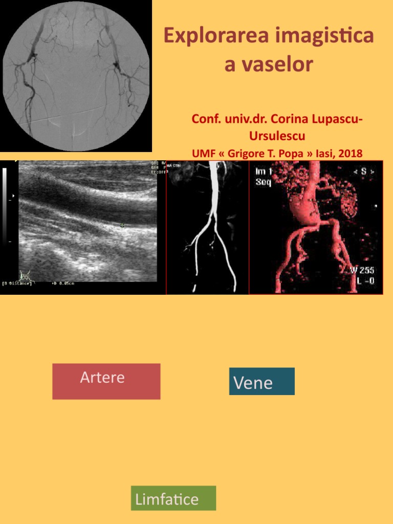 7.RIM Vascular | PDF