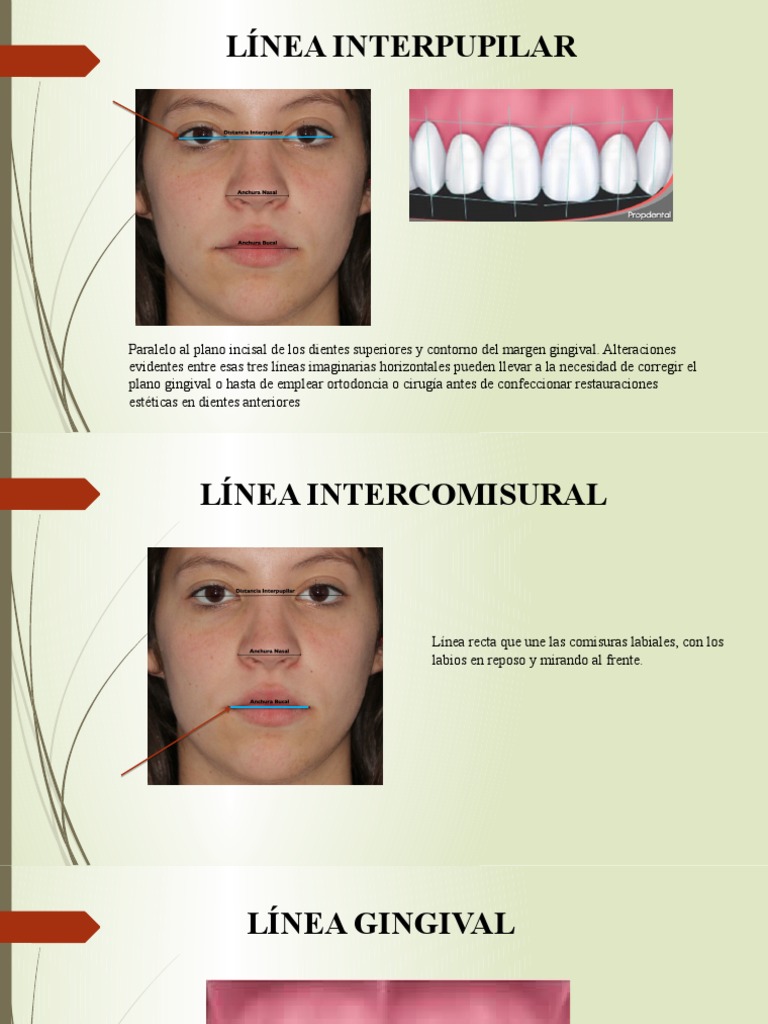 Linea Interpupilar | PDF