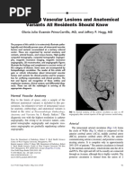 Crochetage' Sign On ECG in Secundum ASD | PDF | Thorax (Human Anatomy ...