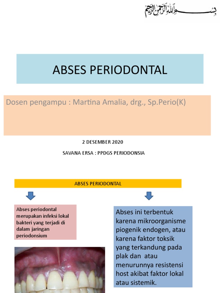 Abses Periodontal-Savana | PDF