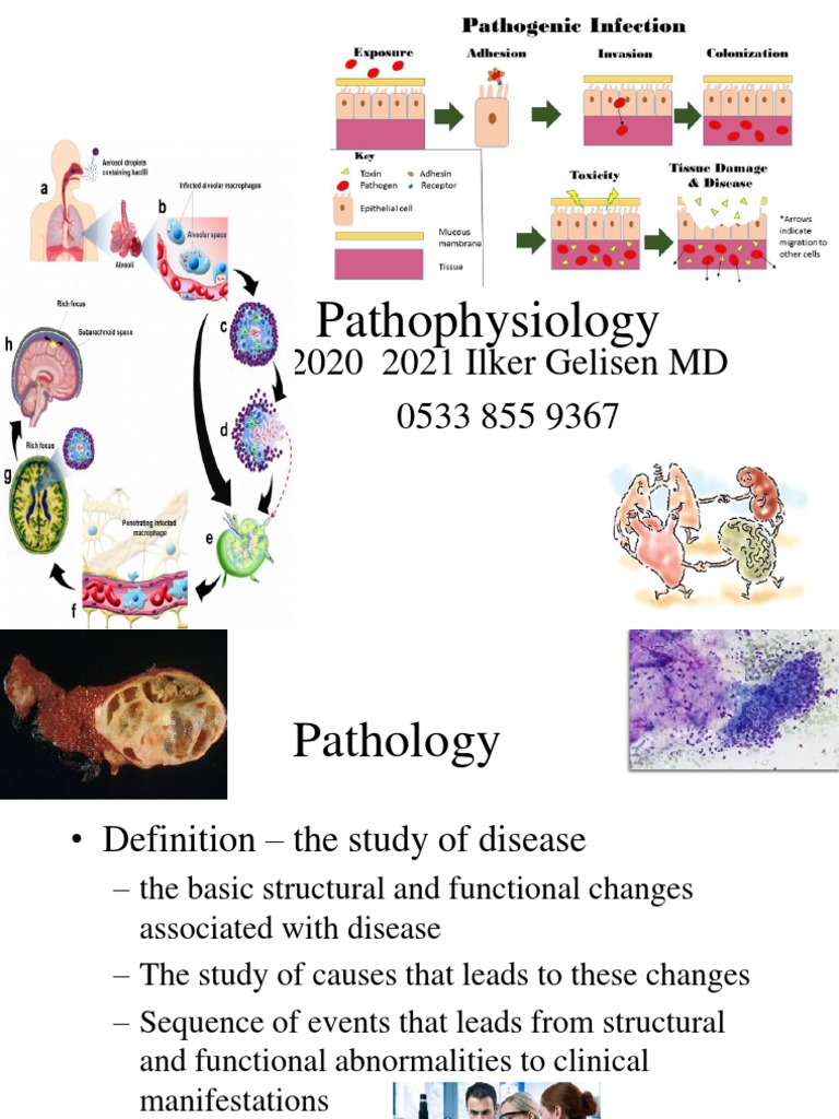 Pathophysiology | PDF | Urinary Tract Infection | Blood Type