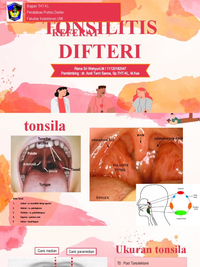 Referat RisnaSw - Tonsilitis Difteri | PDF