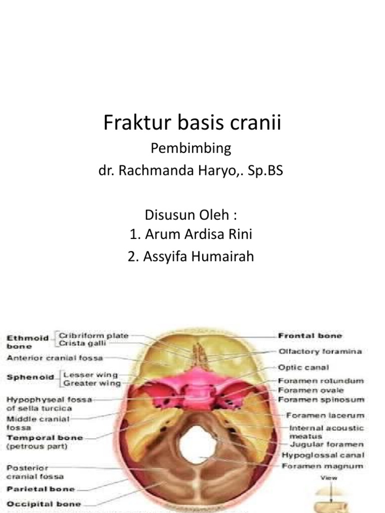 Fraktur Basis Cranii | PDF