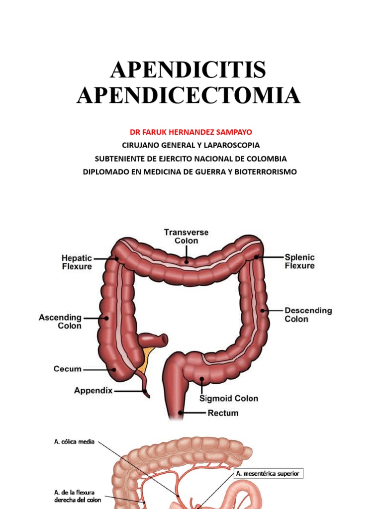 APENDICITIS | PDF