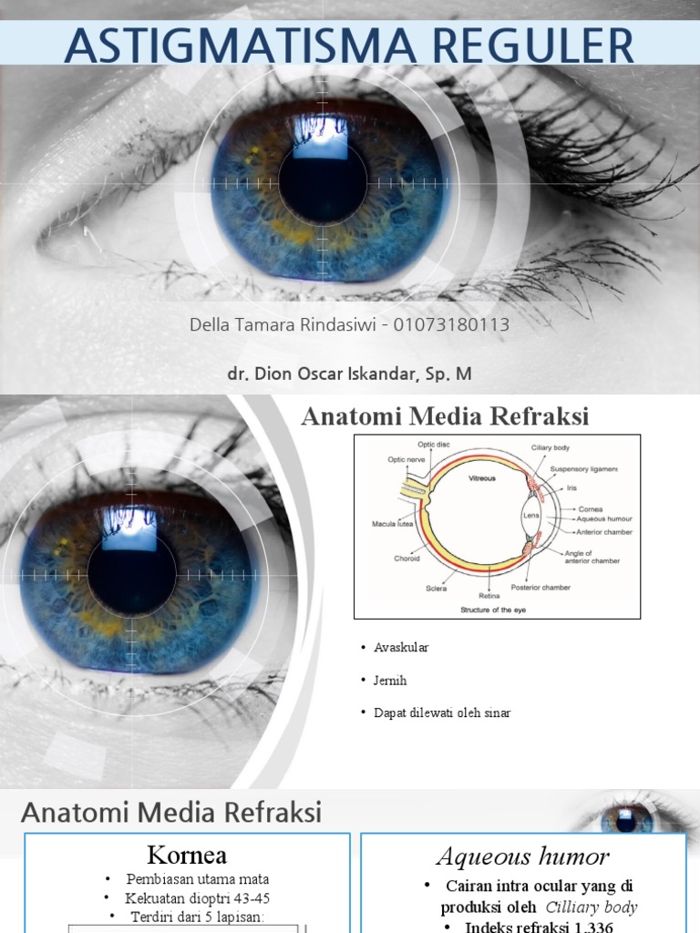 Astigmatism Regular | PDF