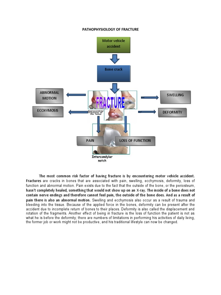 Pathophysiology of Bone Fractures | PDF