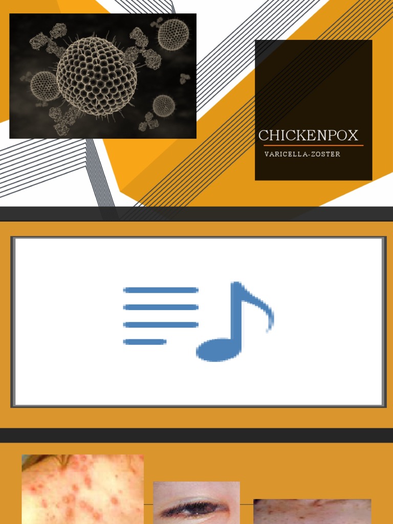 Understanding Chickenpox and its Complications: A Comprehensive Review ...