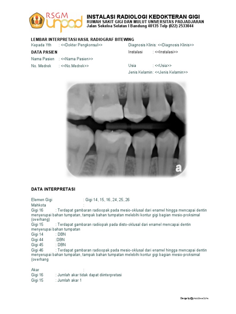 Interpretation of Bitewing Radiograph Results | PDF