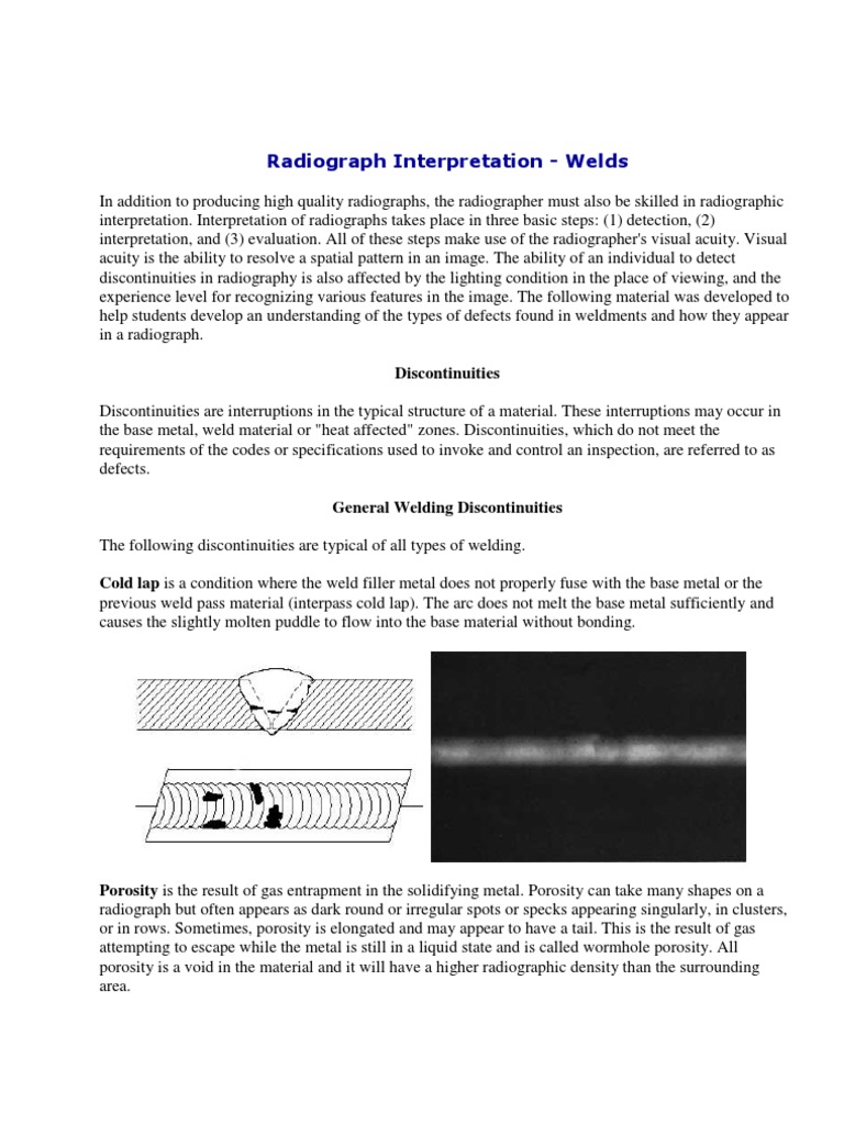 Radiography Interpretations | PDF | Home & Garden | Science & Mathematics