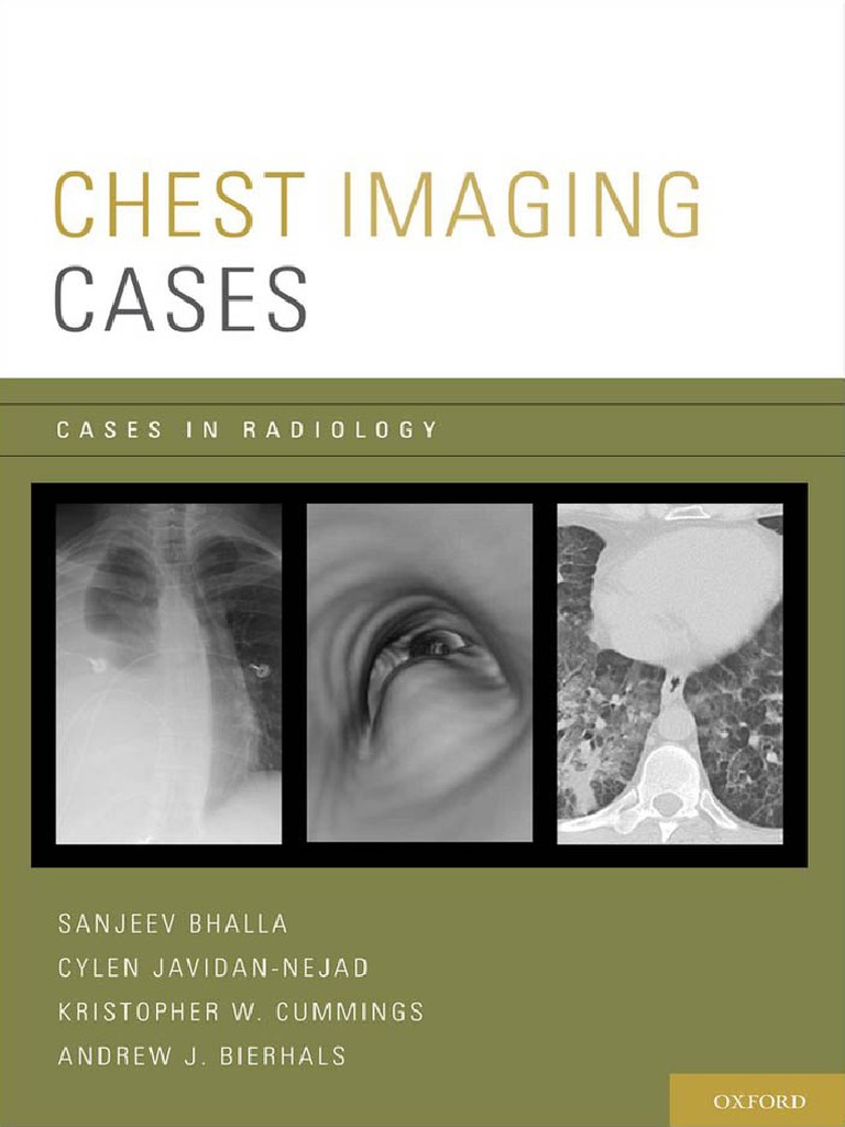 Chest Imaging Cases | PDF | Lung | Pneumonia