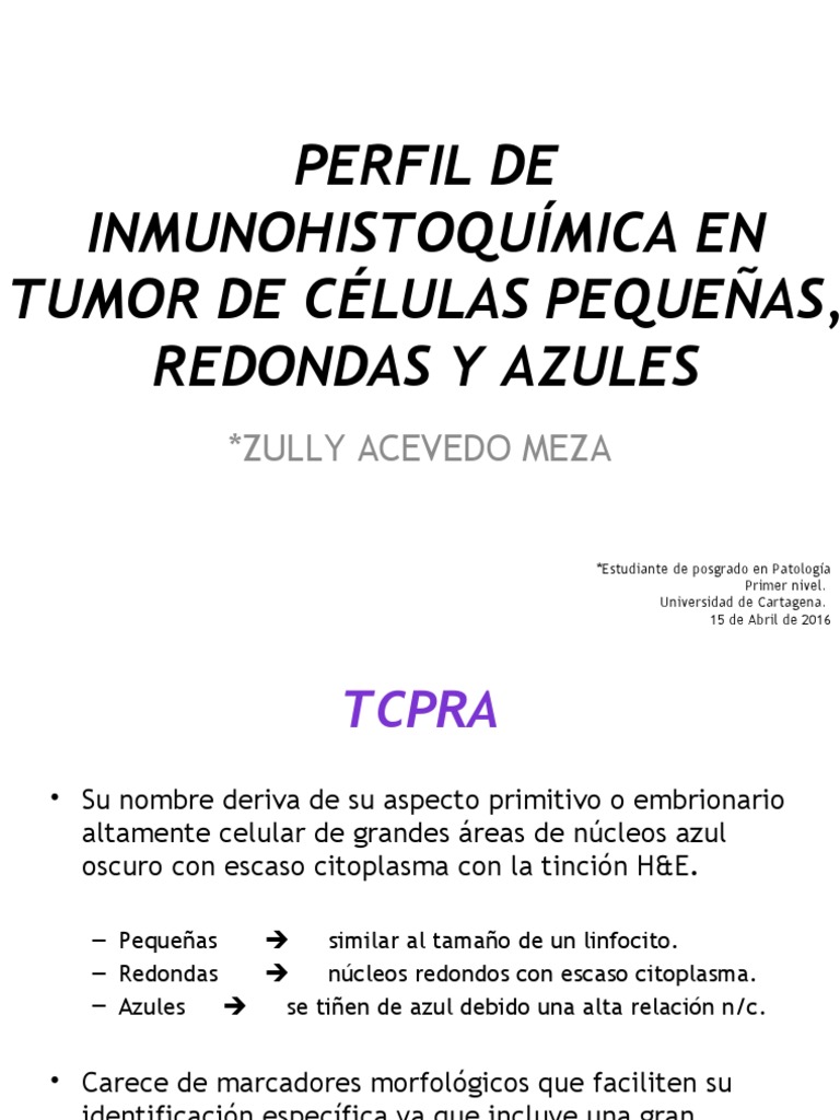 Tumor de Células Pequeñas Redondas y Azules | PDF | Linfoma | Neoplasias
