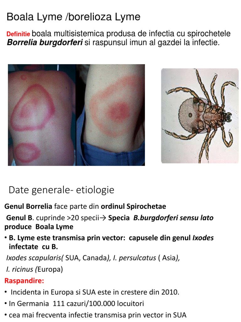 8.a BOALA LYME Borelioza | PDF
