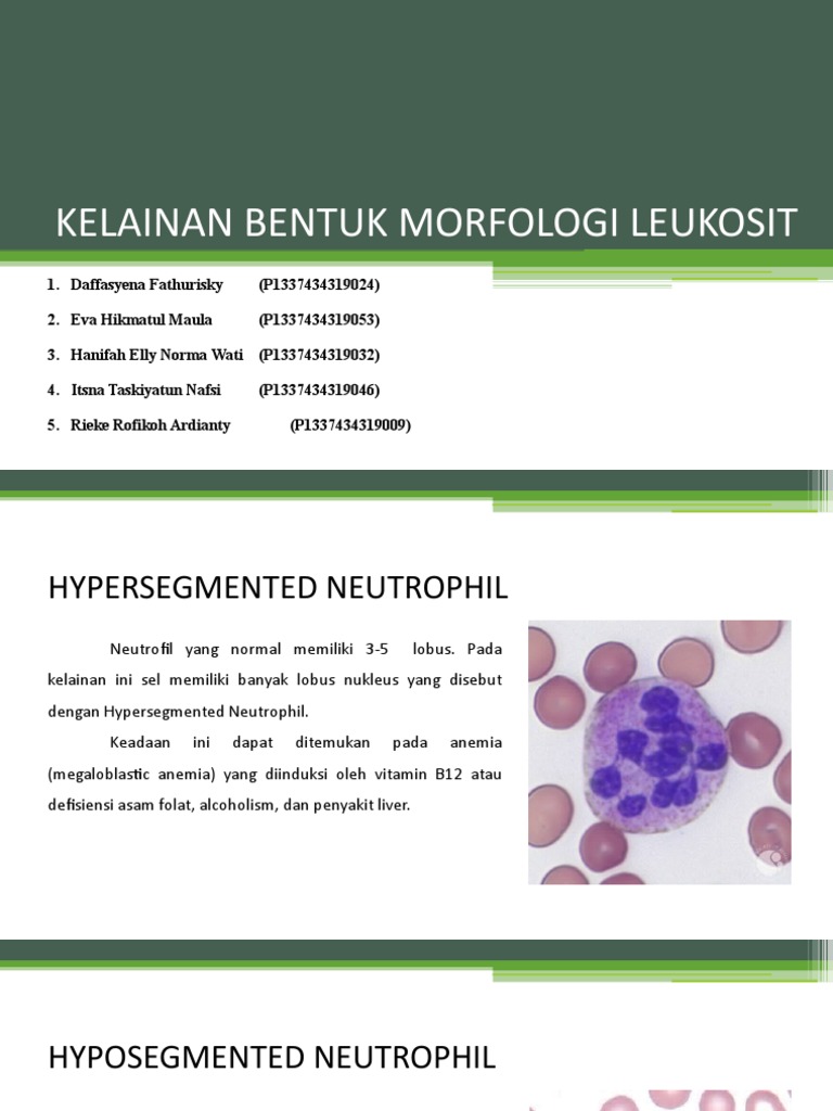 Kel. 7 - Kelainan Bentuk Morfologi Leukosit | PDF