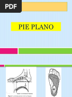 Pie Plano22 - 1 | PDF | Pie | Examen físico