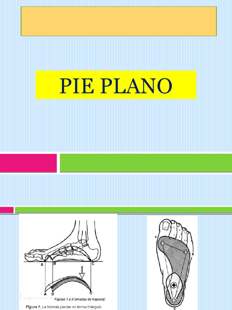 Pie Plano | PDF | Pie | Sistema musculoesquelético