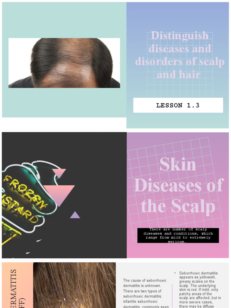 DAY 3.distinguish Diseases and Disorders of Scalp and Hair | PDF ...
