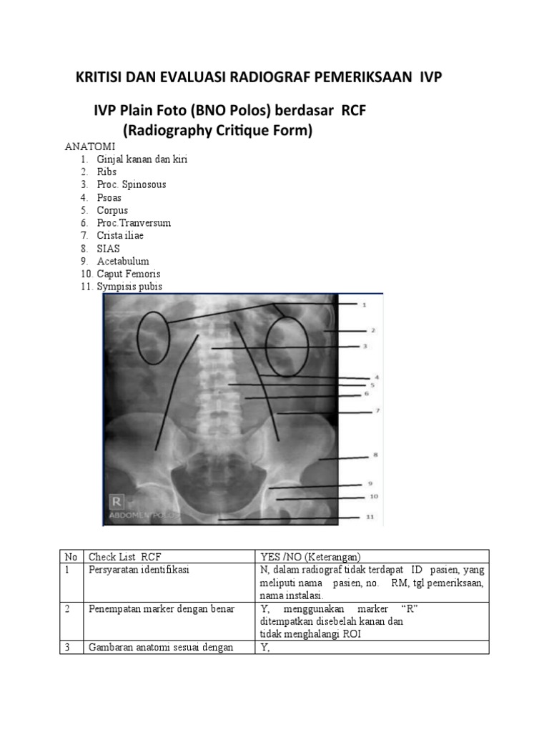 Kritisi Dan Evaluasi Radiograf Pemeriksaan Ivp Tugas 2 | PDF