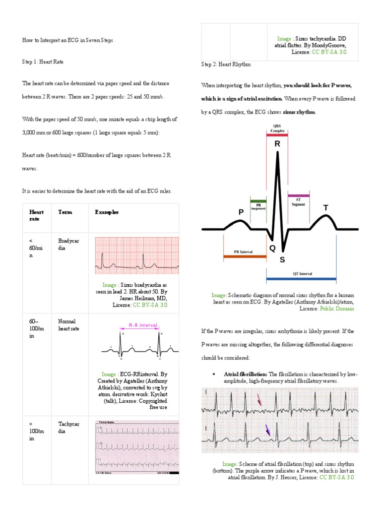 How To Interpret An ECG in Seven Steps | PDF | Electrocardiography ...
