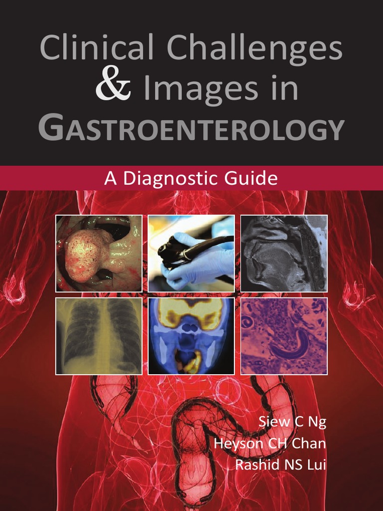 Clinical Challenges and Images in Gastroenterology-A Diagnostic Guide ...