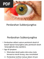 Sop Perdarahan Subkonjungtiva | PDF