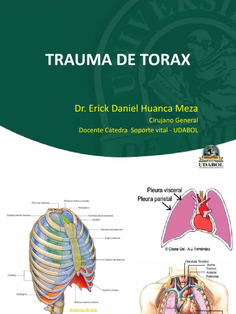 Trauma Toracico 1 | PDF | Lesión | Neumología