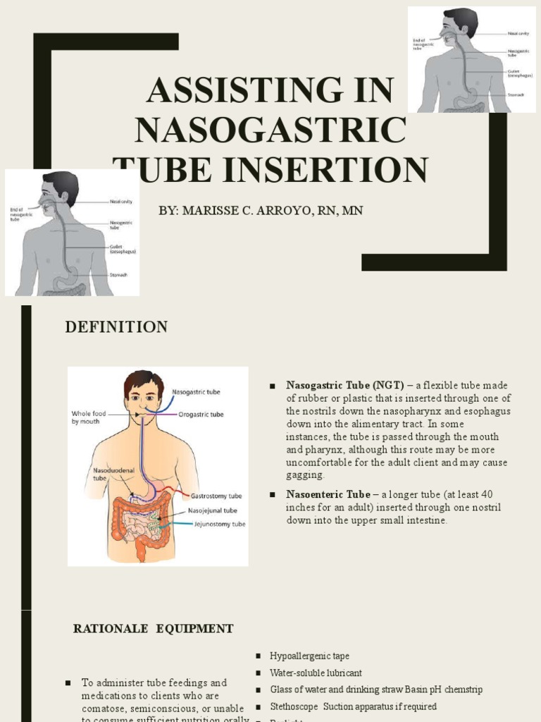 A Guide to the Planning and Implementation of Nasogastric Tube ...