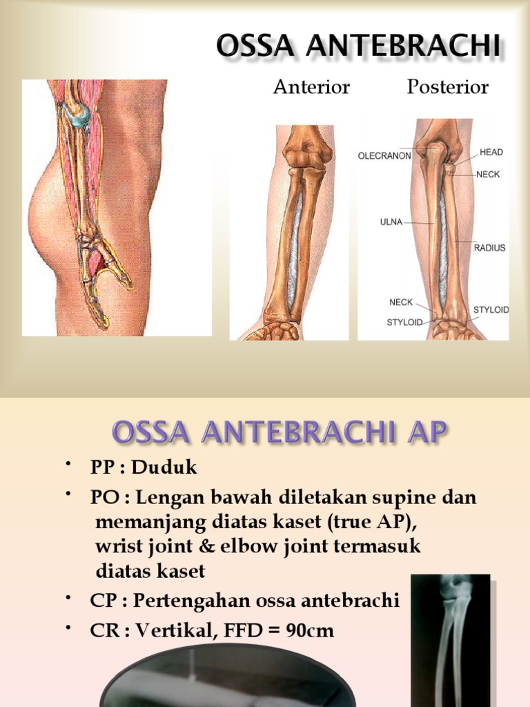 Ossa Antebrachi | PDF