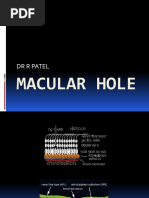 Seidel's Test | PDF | Human Eye | Medical Specialties