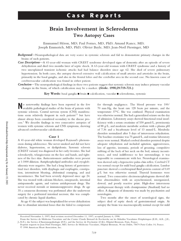 Brain Involvement in Scleroderma | PDF | Clinical Medicine | Medical ...