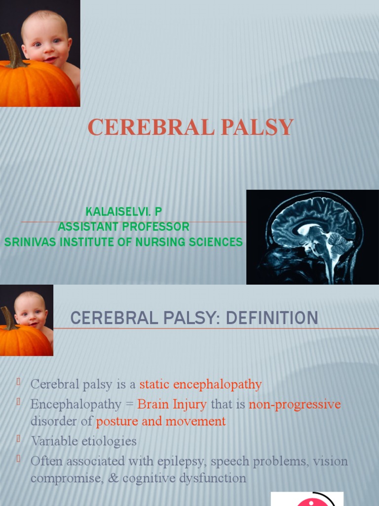 Cerebral Palsy: Kalaiselvi. P Assistant Professor Srinivas Institute of ...