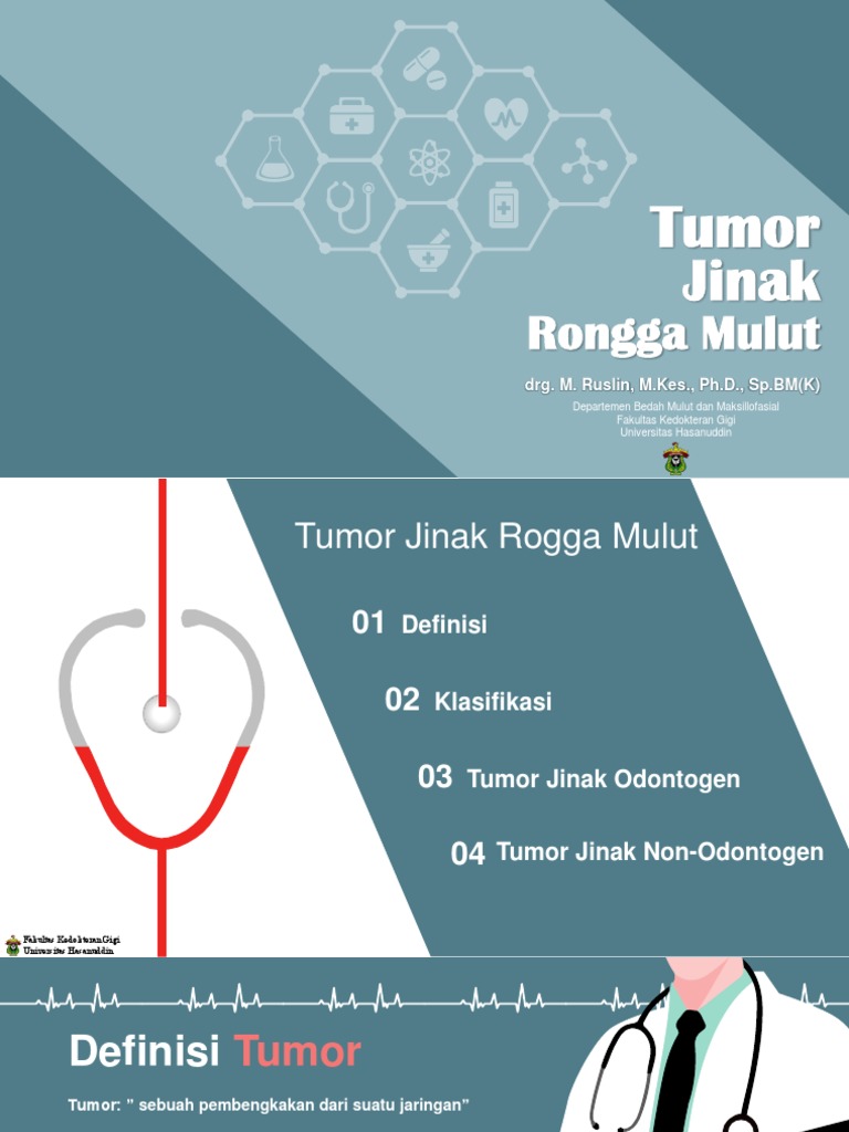 Tumor Jinak Rongga Mulut: Klasifikasi dan Jenis-jenis Tumor Jinak Epitelial dan Jaringan Lunak ...