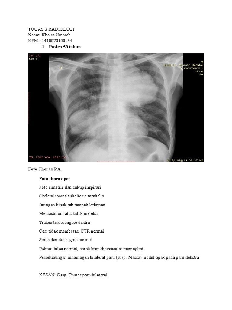 Tugas Radiologi 3 | PDF