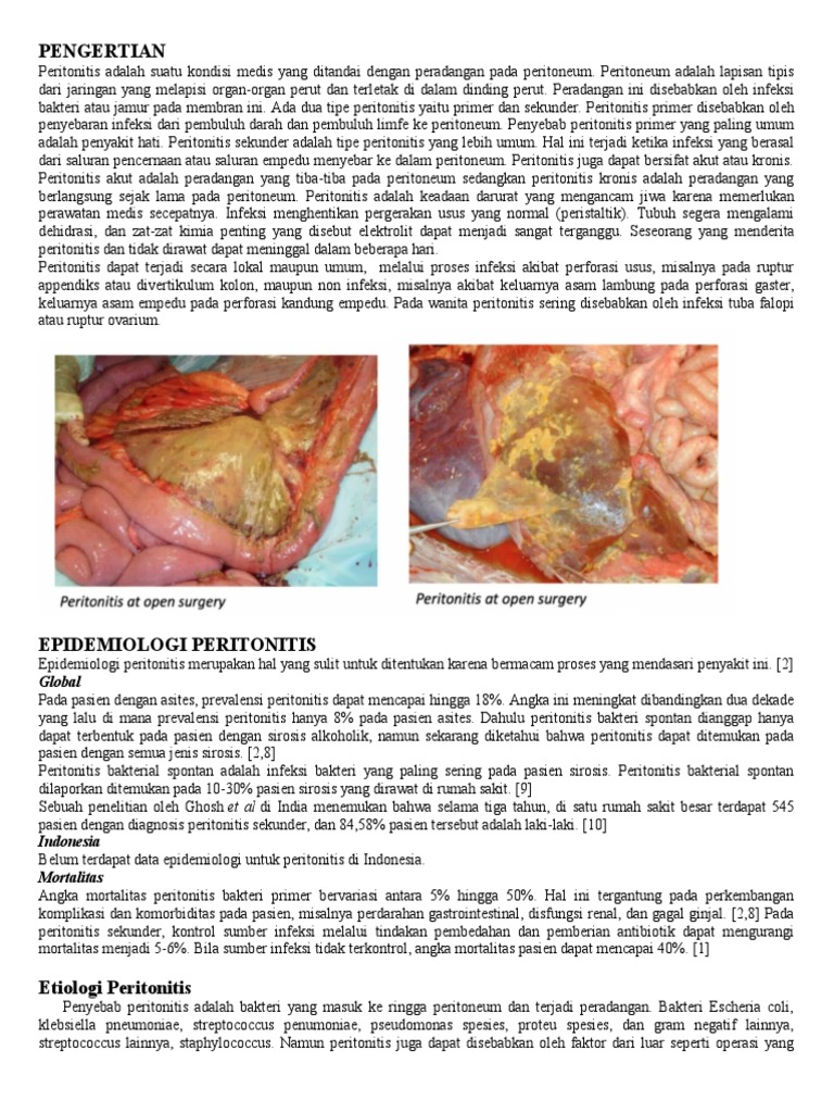 PERITONITIS | PDF | Sains & Matematika | Pengembangan Diri