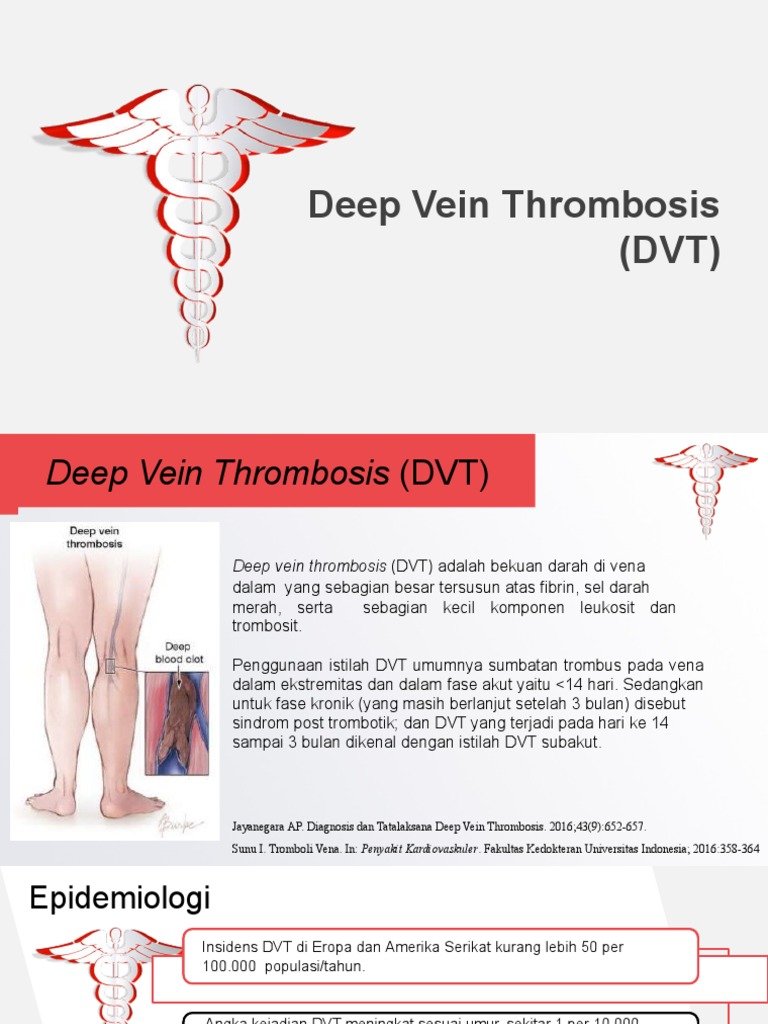 Deep Vein Thrombosis (DVT) | PDF | Sains & Matematika