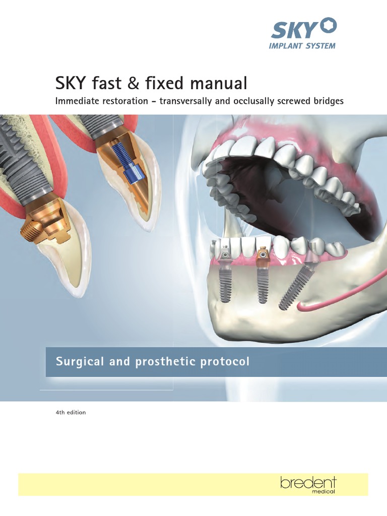 Documentatie Bredent F&F 2 | PDF | Dental Implant | Mouth
