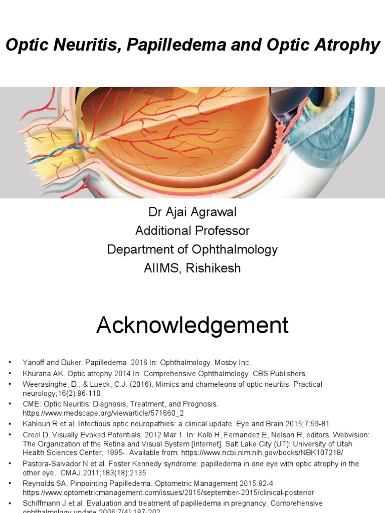 Optic Neuritis, Papilledema and Optic Atrophy | PDF | Human Eye ...
