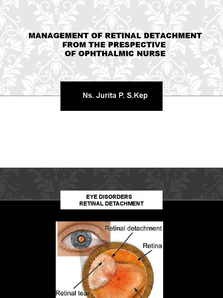 Management of Retinal Detachment From The Prespective | PDF | Retina ...