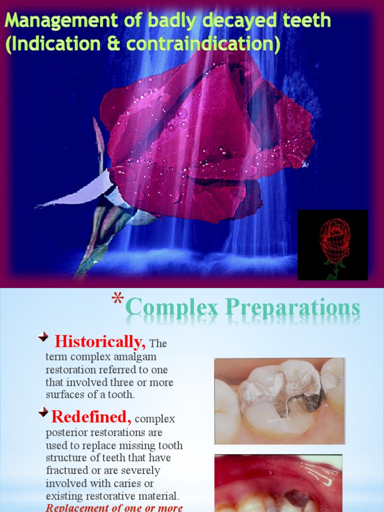 Complex Posterior Restorations Guide | PDF | Human Tooth | Periodontology