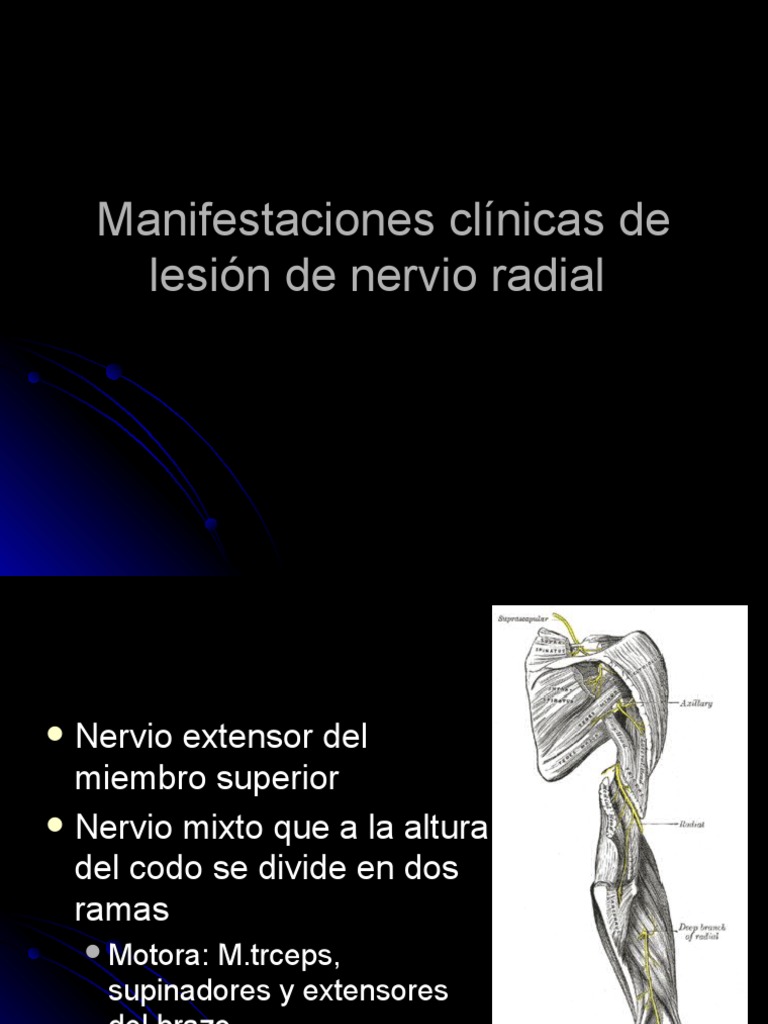 Manifestaciones clínicas de lesión de nervio radial