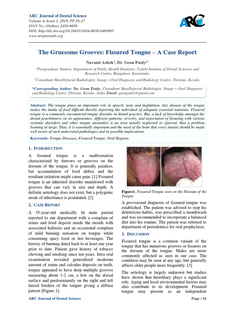 Fissure Tongue | PDF | Tongue | Periodontology