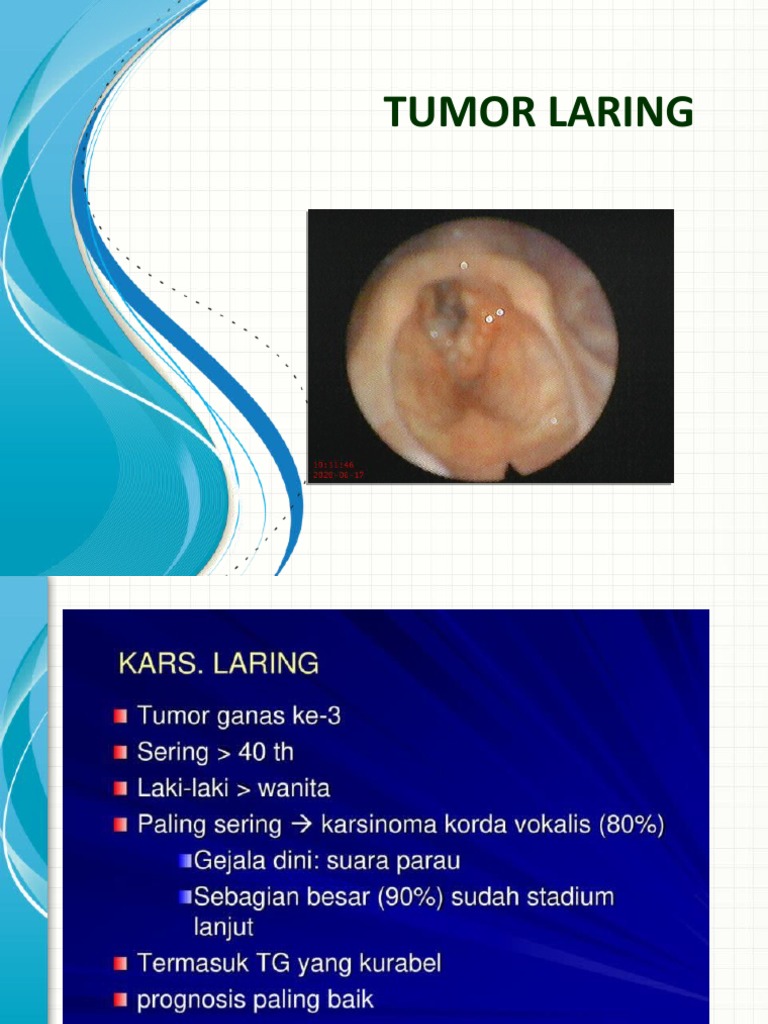Tumor Laring | PDF | Career & Growth